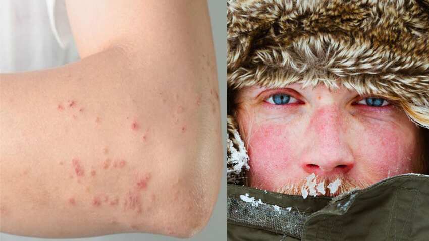 Tips and Tricks: क्या आप हैं परेशान ऊनी कपड़ों से?होती हैं उनसे ...