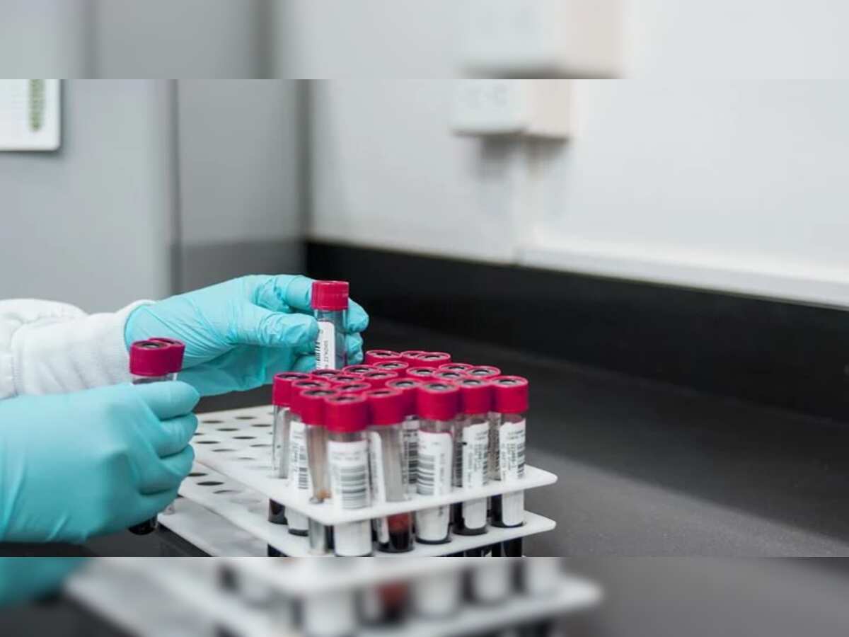 EMM Negative Blood Group: India's 1st person from Gujarat! What is it ...