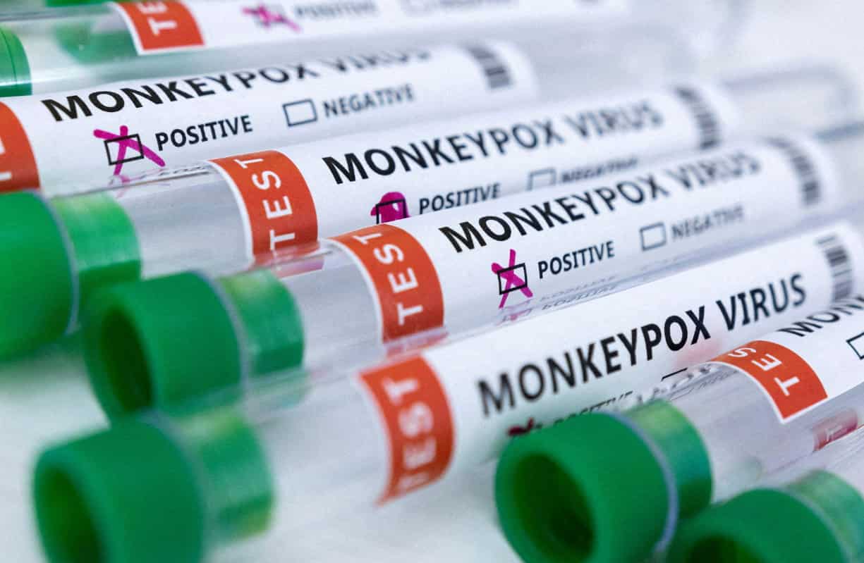 Monkeypox virus outbreak in children: Andhra boy shows symptoms ...