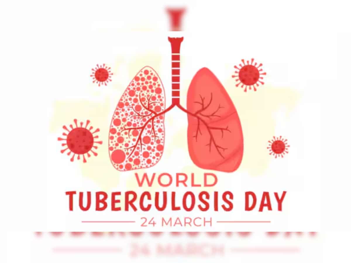 World TB Day 2025: A look at Its history, theme, and why it matters | Zee Business