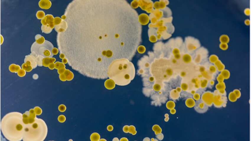 Bacterial enzyme that turns air into electricity discovered | Zee Business